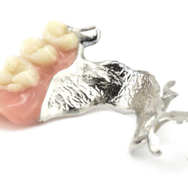 Partial Dentures • Synergy Dental Clinic