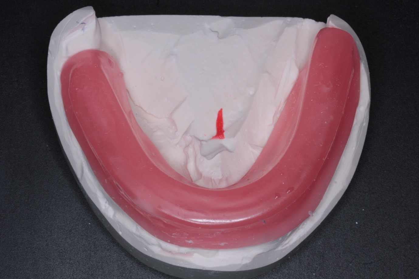 Case Study: Implants and Patient Confidence • Synergy Dental Clinic