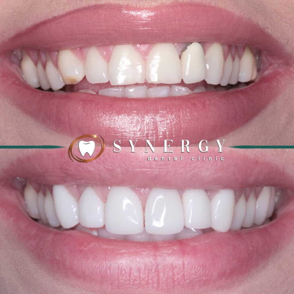 Dr. Zuber Bagasi • Synergy Dental Clinic